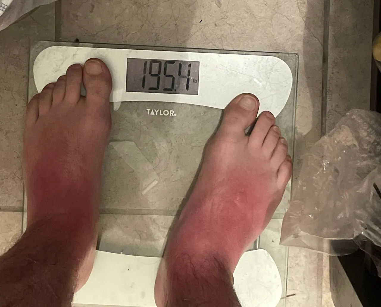 Daily Caller Reporter Drops 9 Pounds Halfway Through MAHA ...
