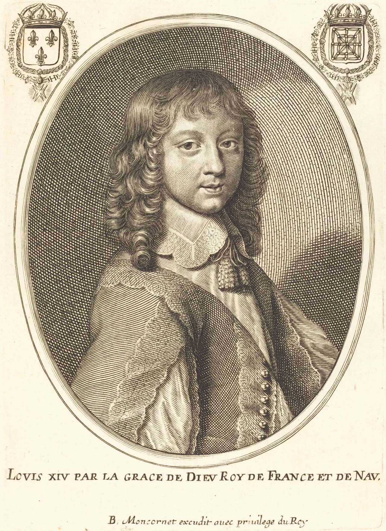 Scientists Challenge Louis XIV’s Cause Of Death After Studying ...