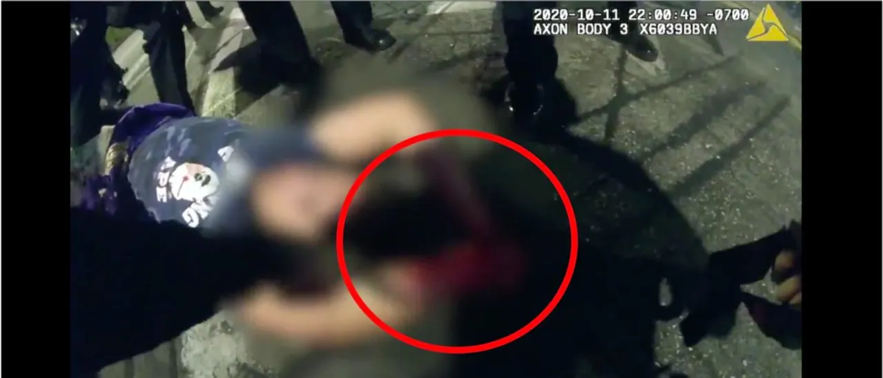 Los Angeles Lakers Fan Blows His Hand Off With A Firework In Graphic ...