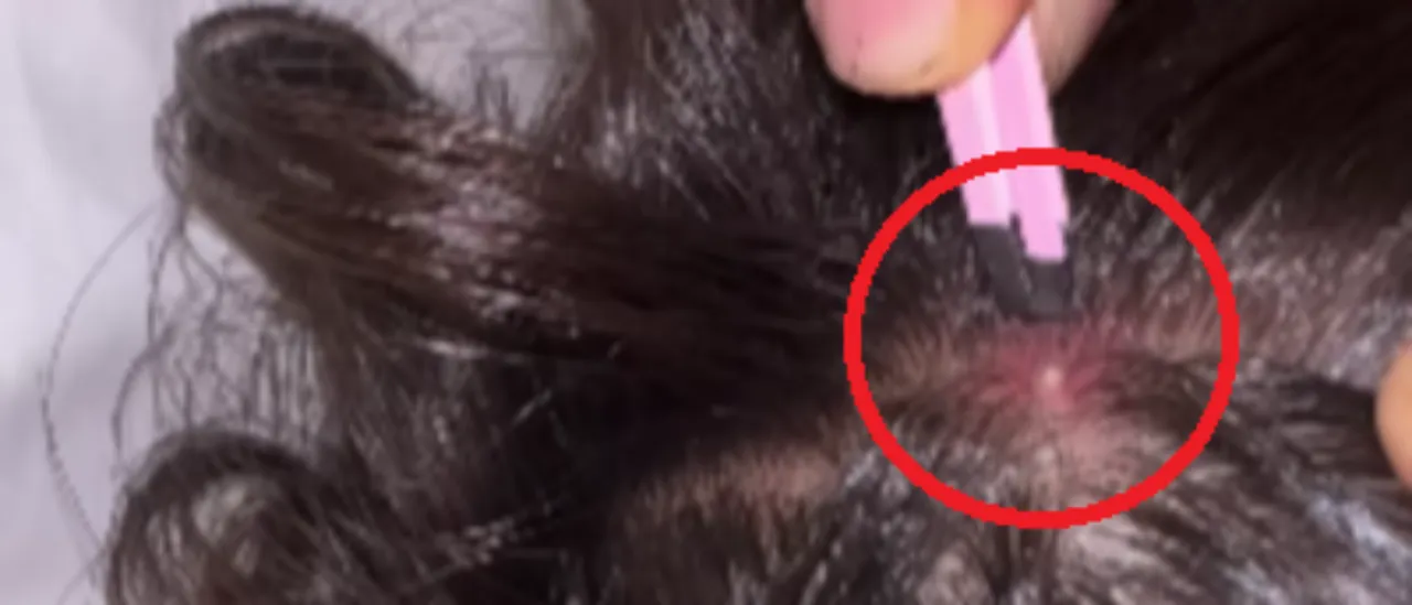 ‘Not For The Faint Of Heart’: Video Appears To Show Dad Extracting Bot ...