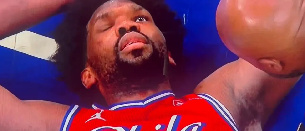 NBA Superstar Joel Embiid’s Eyes And Forehead Have Been Acting Very ...